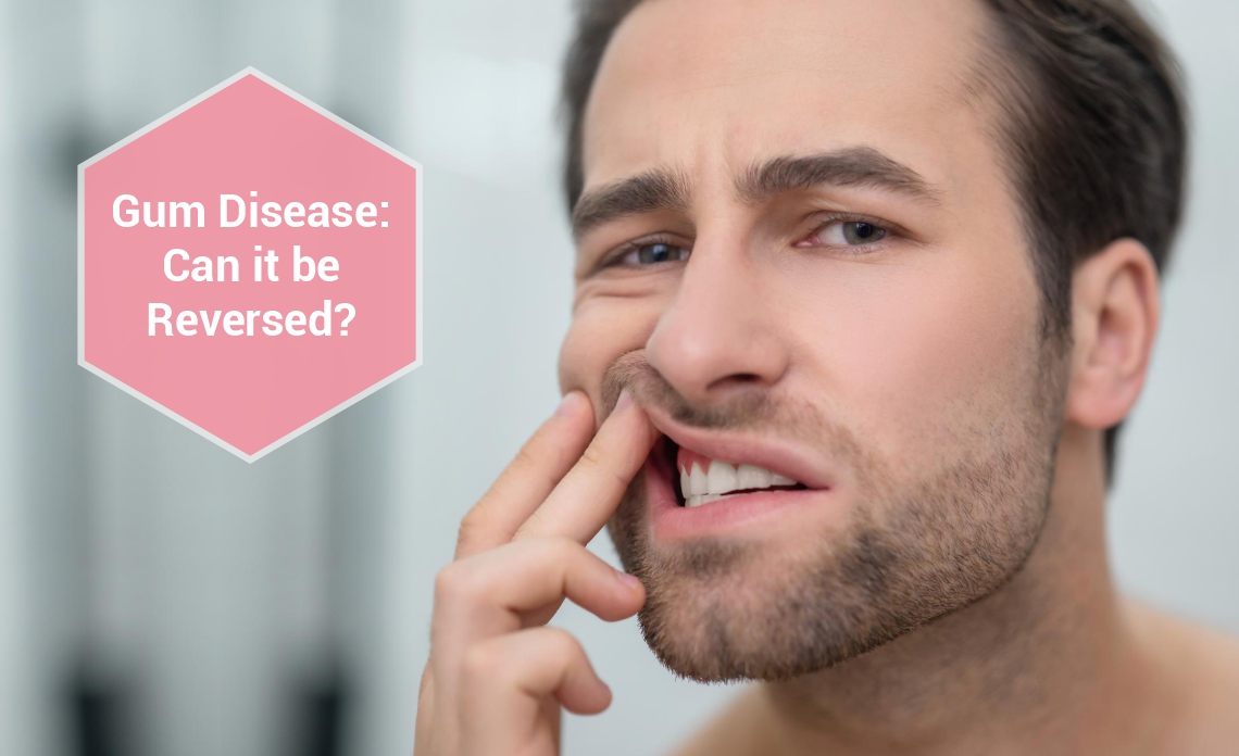 Best Dental Clinic in Bopal, Ahmedabad | Dentist in Ahmedabad